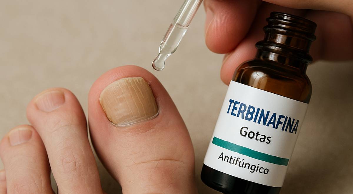 Terbinafina en gotas: ¿para qué sirve y cómo se usa? en Perú
